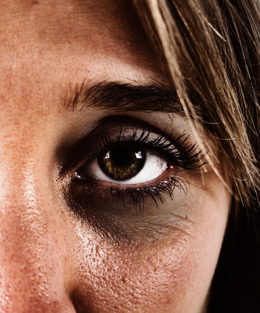 Dark Circles Under Eyes Treatments Hair Skin Science