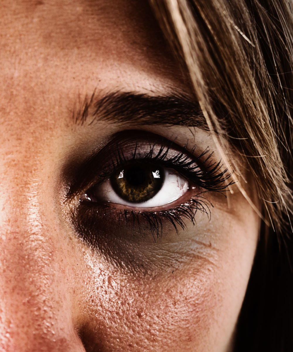 Dark Circles Under Eyes Treatments Hair Skin Science