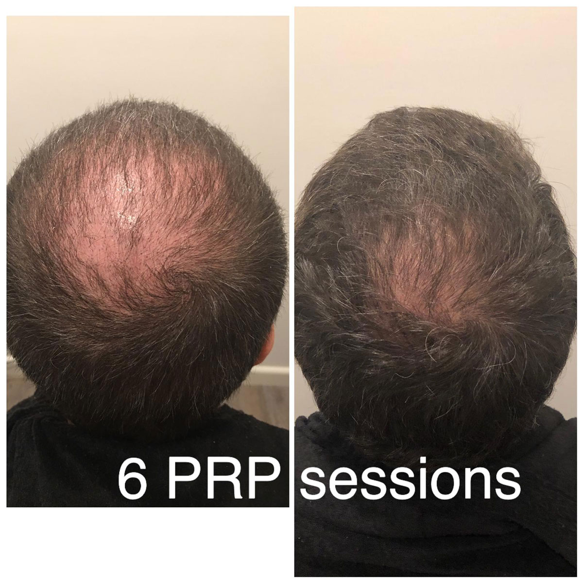 Before & Afters - Hair & Skin Science