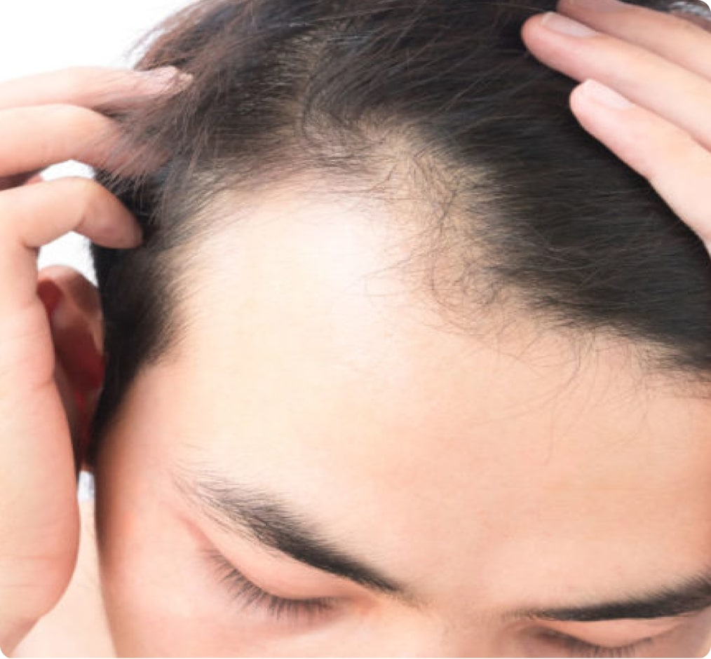 Berwick PRP Hair Loss & Skin Clinic Victoria