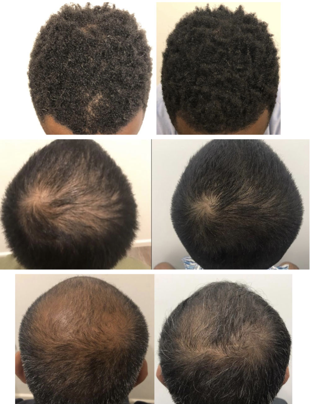 Before & Afters - Hair & Skin Science