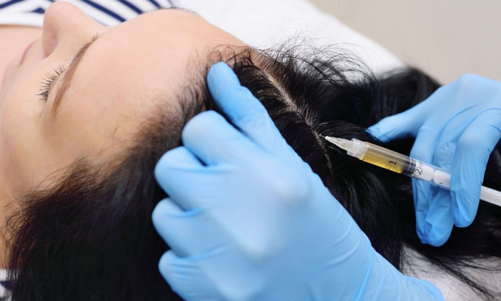 PRP Hair Loss Treatment & Skin Clinics in Melbourne & Sydney