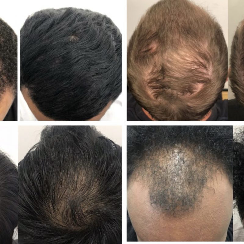 Before & Afters - Hair & Skin Science