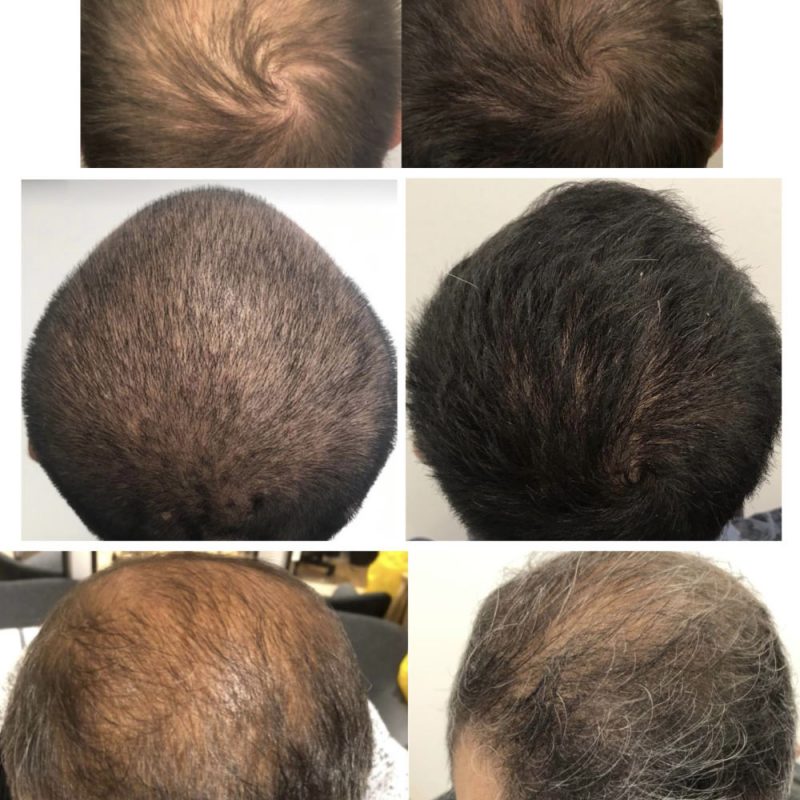 Before & Afters - Hair & Skin Science