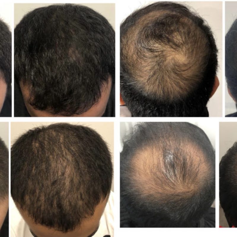 Before & Afters - Hair & Skin Science