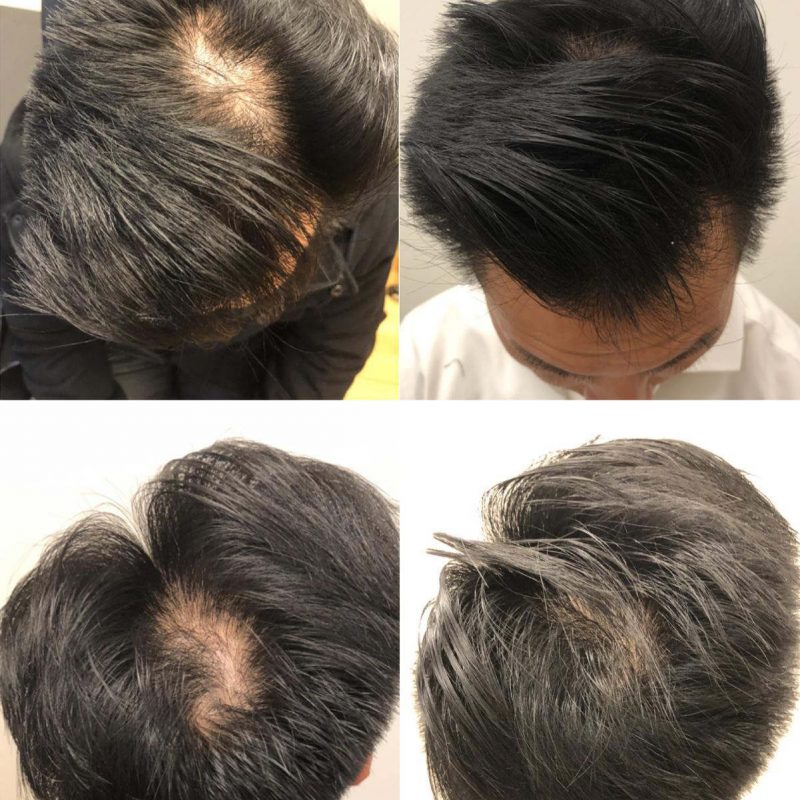 Before & Afters - Hair & Skin Science