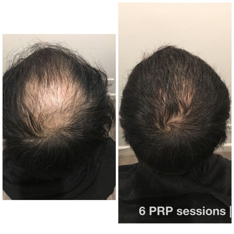 Before & Afters - Hair & Skin Science
