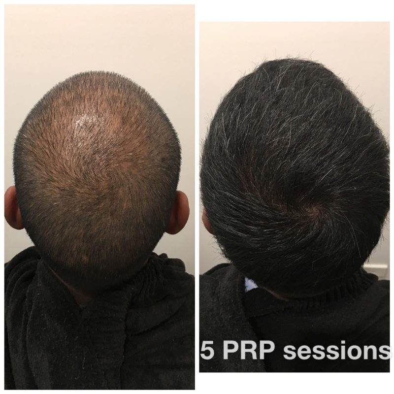 Before & Afters - Hair & Skin Science